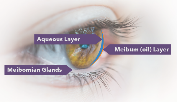 dry-eye-sibia-1 | Sibia Eye Institute